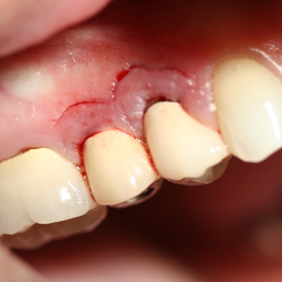 Dentistry by Mark Dennis, DDS