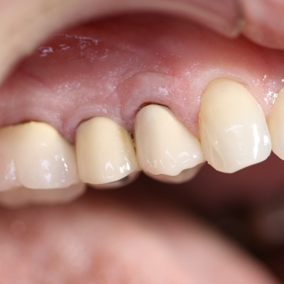 Dentistry by Mark Dennis, DDS